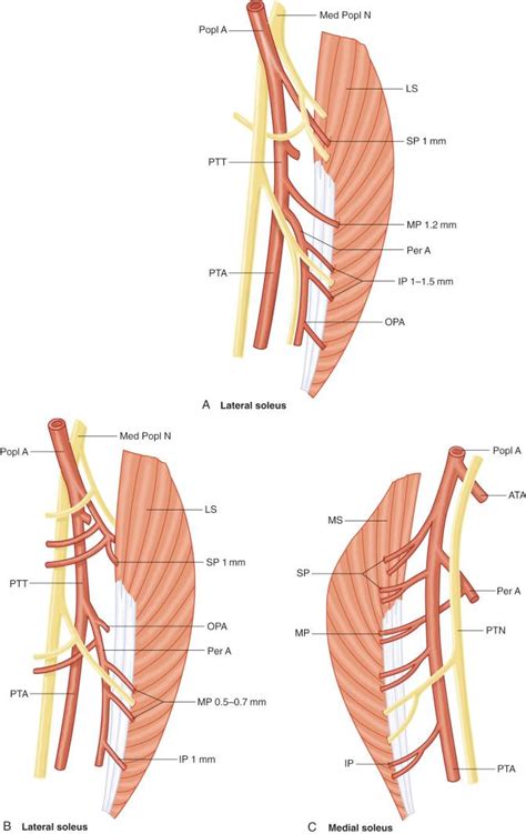 Soleus Flap Clinical Tree