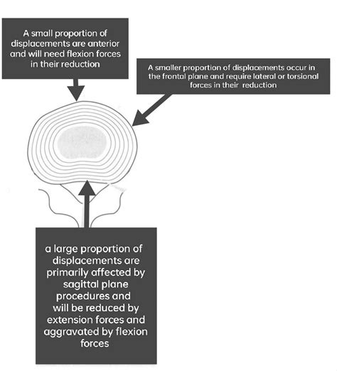 Role Of Mri In Spine Physical Therapy Practice Orthopaedic Manipulation