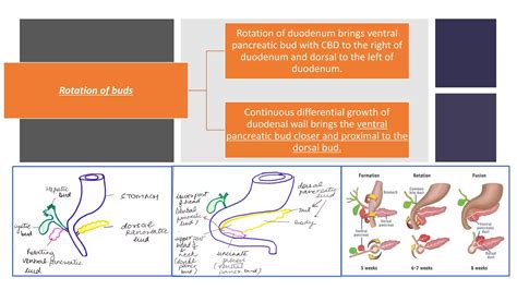 Development Of Liver Pancreas Spleen And Extrahepatic Biliary