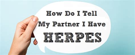 Sex With Herpes Guidelines For A Safefulfilling Sex Life
