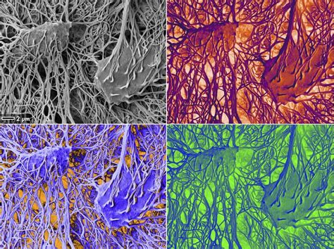 Hadi Taghizadeh On Linkedin Osteocytes Network Structure Follows Function Bone Remodeling…