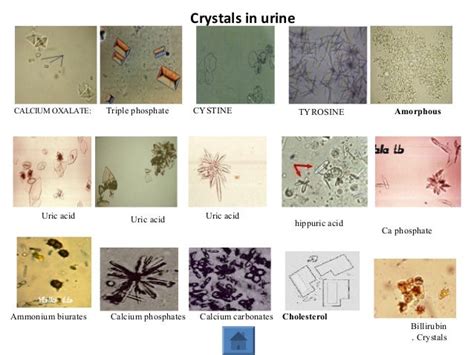 Leukocytes In Urine Chart