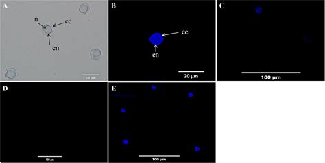 Anti Acanthamoeba Activity Of A Semi Synthetic Mangostin Derivative And Its Ability In Removal