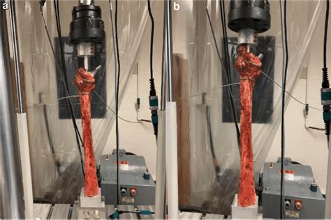 A Cadaveric Femur With Cables After Periprosthetic Fracture B
