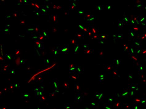 Fluorescence Microscopy Bacteria