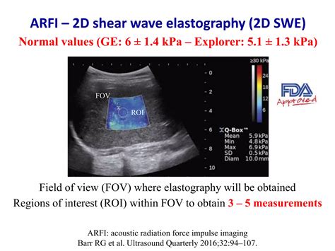 Assessment Of Liver Fibrosis By Us Elastography Pptx