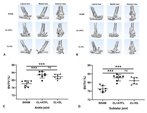 A Mouse Model Of Ankle Subtalar Complex Joint Instability