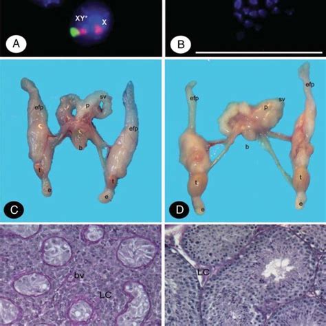 A And B Fish For The Detection Of A Supernumerary X Chromosome In Xx Y