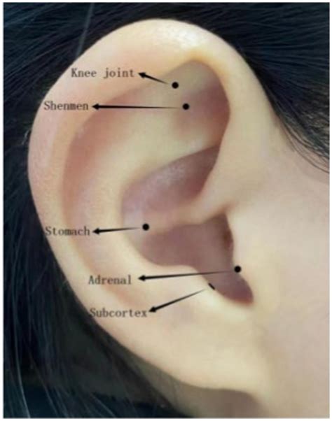 Frontiers Effectiveness And Safety Of Auricular Acupuncture On