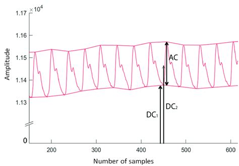 Ac Dc Values Of The Typical Ppg Signal Download Scientific Diagram