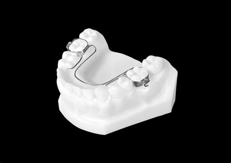 W Arch Lower Universal Orthodontic Lab