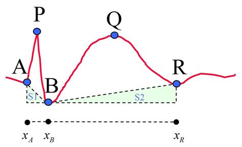 Model Based Spike Detection Of Epileptic Eeg Data