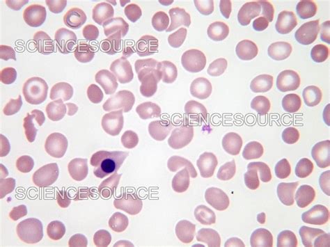 Nucleated Red Blood Cells