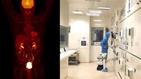 Why We Did It Acquiring Advanced Accelerator Applications Molecular Imaging