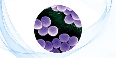 Infecciones Por Estafilococo Aureus Lo Que Todo Especialista Necesita Saber