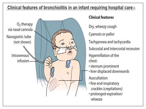 Bronchiolitispptx