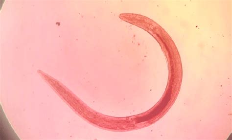 Microscopic View Of The Worm Download Scientific Diagram