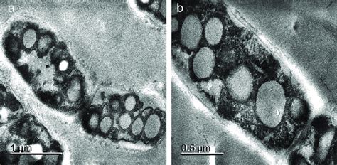 Electron Microscopy Of The Polyhydroxyalkanoates Granules Accumulated
