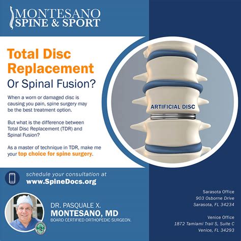 What Is A Total Disc Replacement At Stephanie Goddard Blog