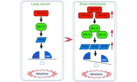 Articles Journal Of Cancer Metastasis And Treatment Oae