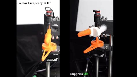 Control And Implementation Of A Fluidic Elastomer Actuator For Active Suppression Of Hand Tremor