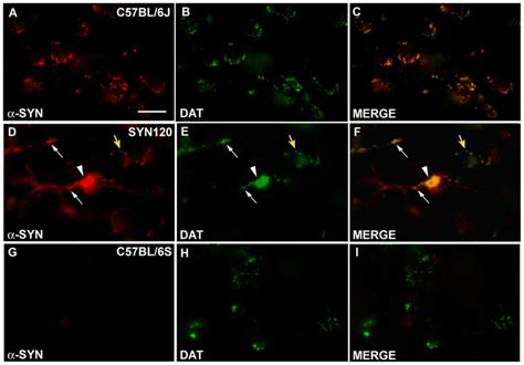 Dat And A Synuclein Double Staining In The Substantia Nigra Dat Green Download Scientific