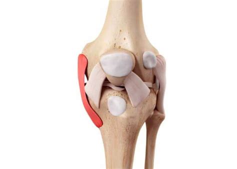 Mpfl Medial Patellofemoral Ligament Treatment And Tips