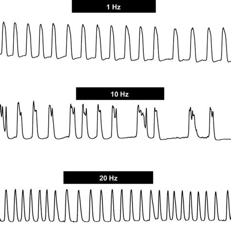 Raw Traces Of Isovolumetric Bladder Reflex Contraction Mmhg Following Download Scientific