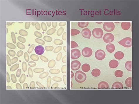 Ppt Hematology Powerpoint Presentation Free Download Id2272776