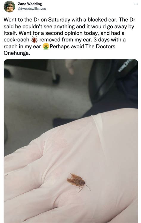 Cockroach Found Living In Mans Ear For Three Days In New Zealand