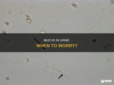 Mucus In Urine When To Worry Medshun