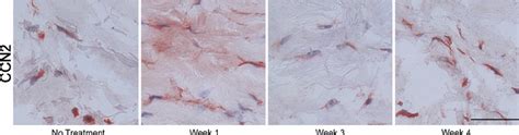 Ccn2 Protein Expression During Dermal Repair Skin Samples Were