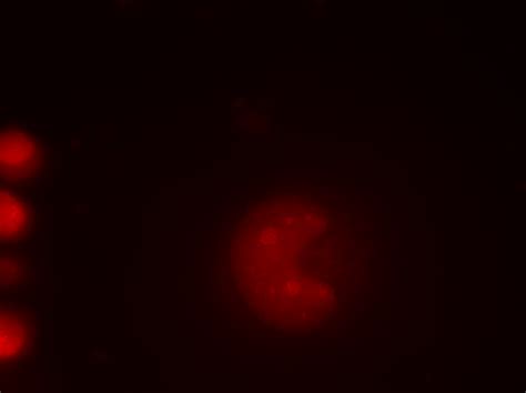 Measuring Fluorscence Intensity In Fiji Researchgate