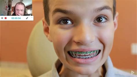 Getting His Braces Off Forever Getting Braces Taken Off After Four