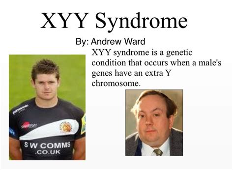 Xyy Syndrome On Flowvella Presentation Software For Mac Ipad And Iphone