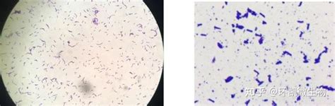 肠道护卫菌”——双歧杆菌的分离、培养及鉴定分享 知乎