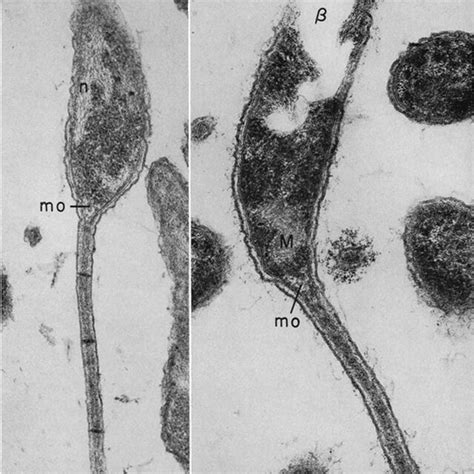 And 5 Thin Sections Of Caulobacter Crescentus Cb15 Figure 4 Gro~m In