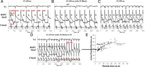 Repolarization Alternans Reveals Vulnerability To Human Atrial Fibrillation Circulation