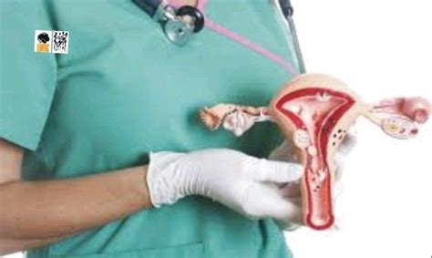 Wharc Nigeria On Linkedin Cervical Cancer Screening In Former Sex