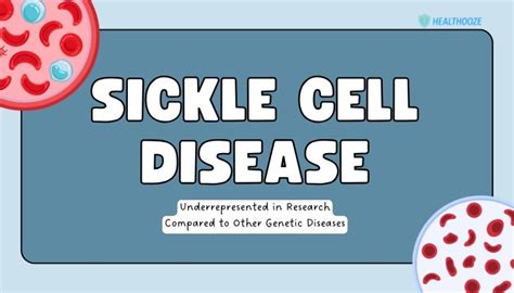 Sickle Cell Disease Underrepresented In Research Compared To Other