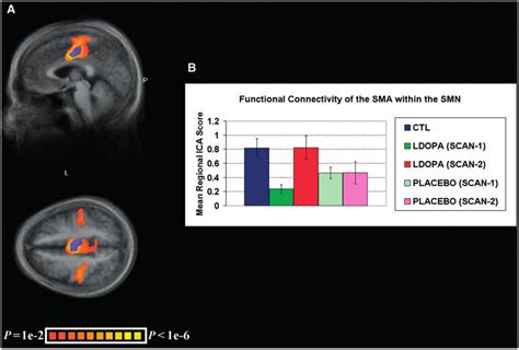 region of interest based analysis of the sensorimotor network