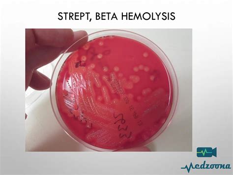 3 Gpb Gram Positive Treptococcus Bacteria Ppt