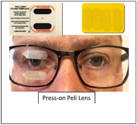 Prism Glasses For Hemianopsia At Willis Beane Blog