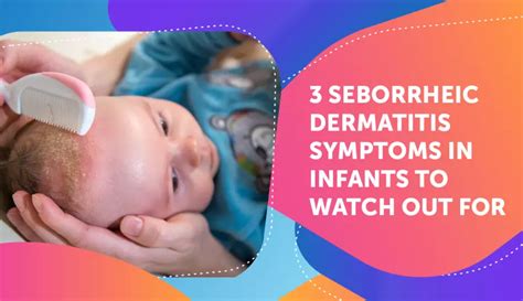 Infant Seborrheic Dermatitis Scalp Treatment Symptoms And Seborrheic