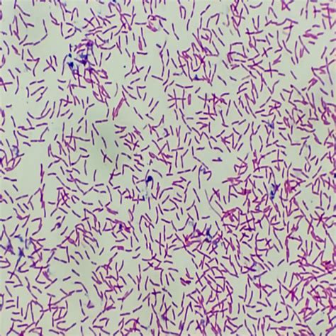 Bacteria Object Detection Dataset By Folder