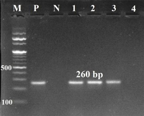 Pcr Amplification Targeting 28s 18s Rrna Intergenic Spacer M 100 Bp Download Scientific