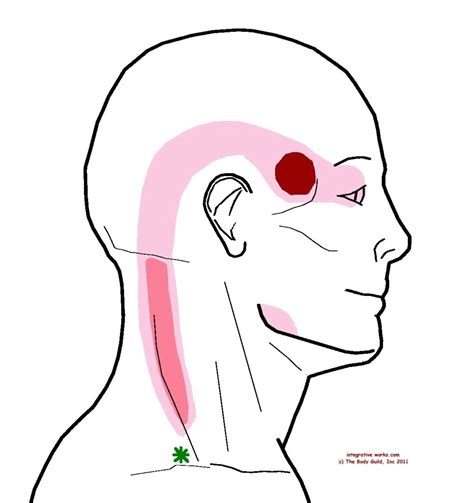 Headache At Your Temple With Stiff Neck Integrative Works