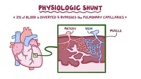 Pulmonary Shunts Osmosis
