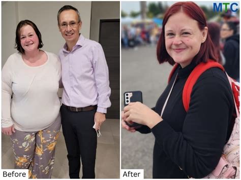 Dr Hector Perez Corzo Request A Quote