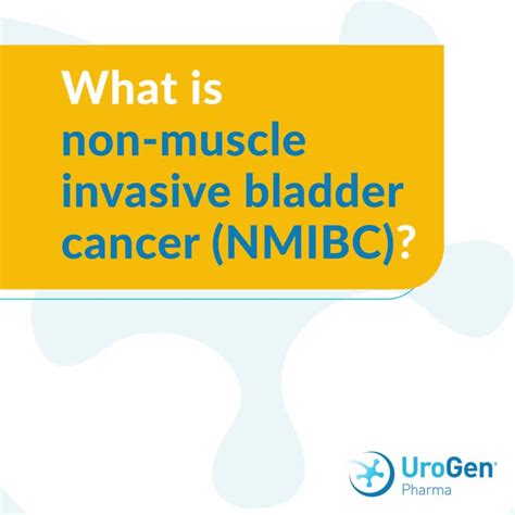 Urogen Pharma On Linkedin Learn More About Nmibc